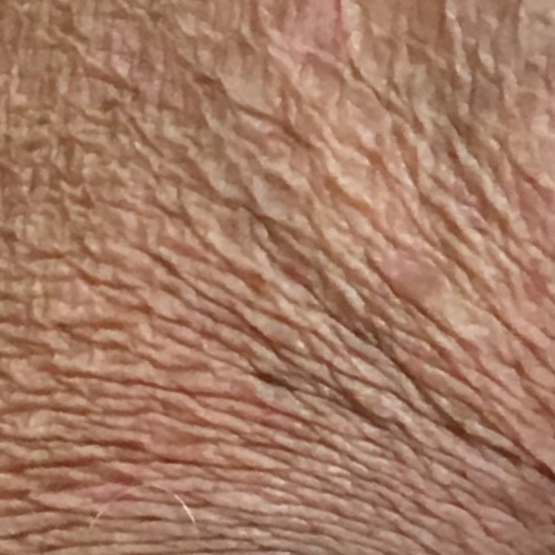 Our Philosophy On What Causes Skin Aging | Dr. Loretta