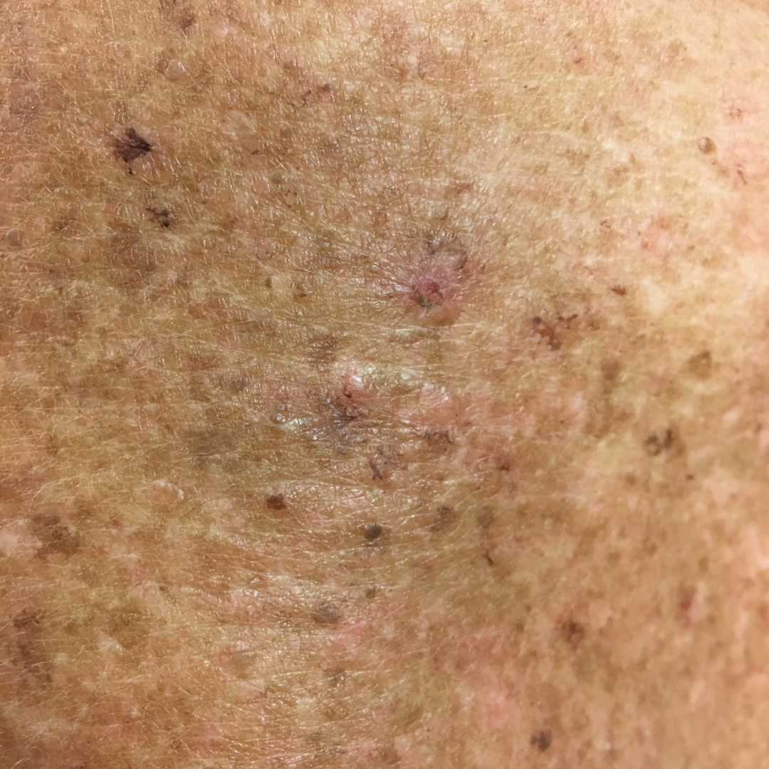 Our Philosophy On What Causes Skin Aging | Dr. Loretta